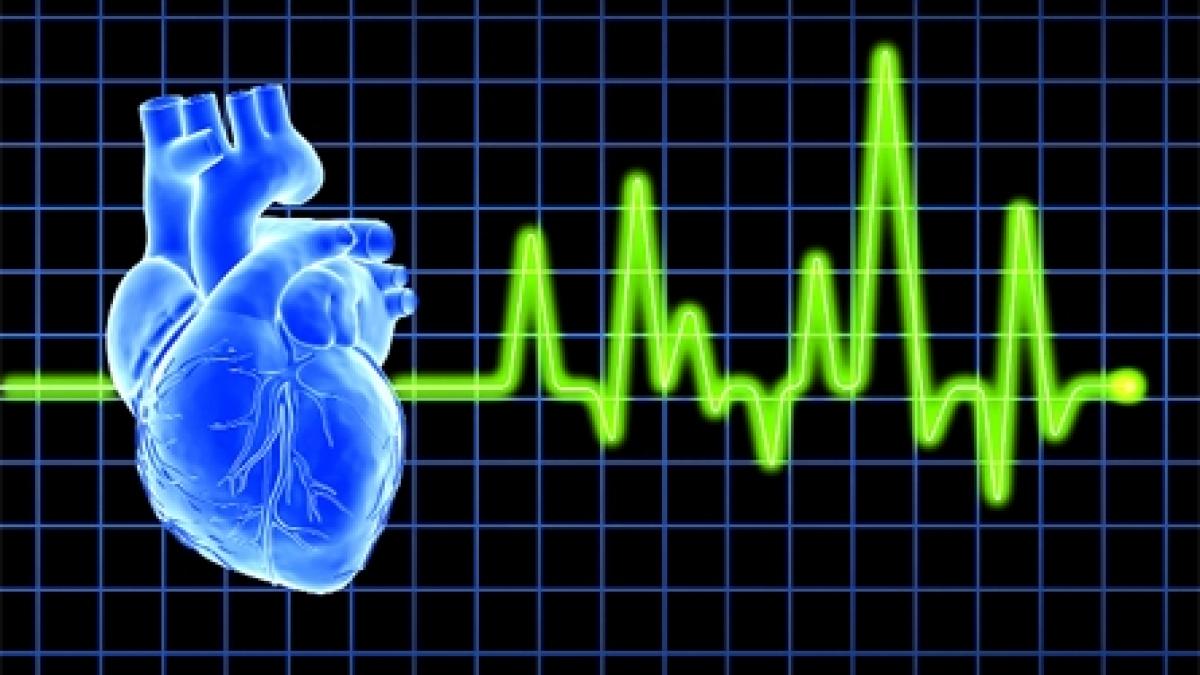 Infarctul de miocard