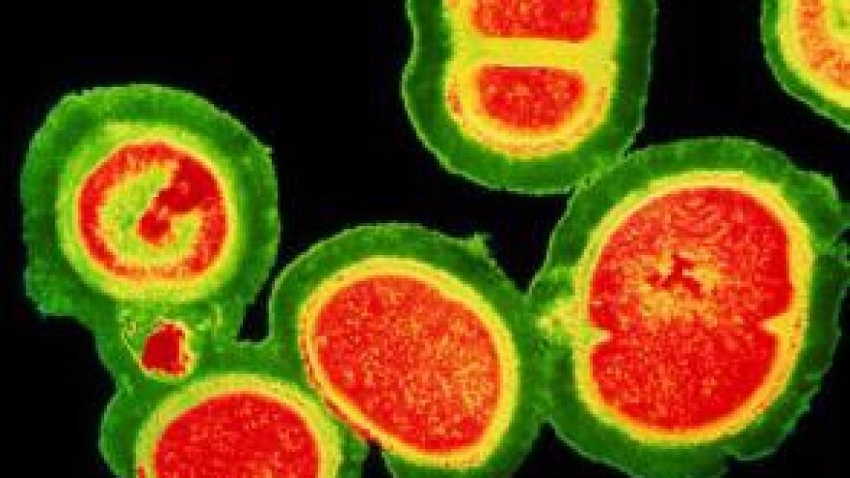 Englezii au iar probleme cu vacile: laptele cu stafilococ auriu a ...