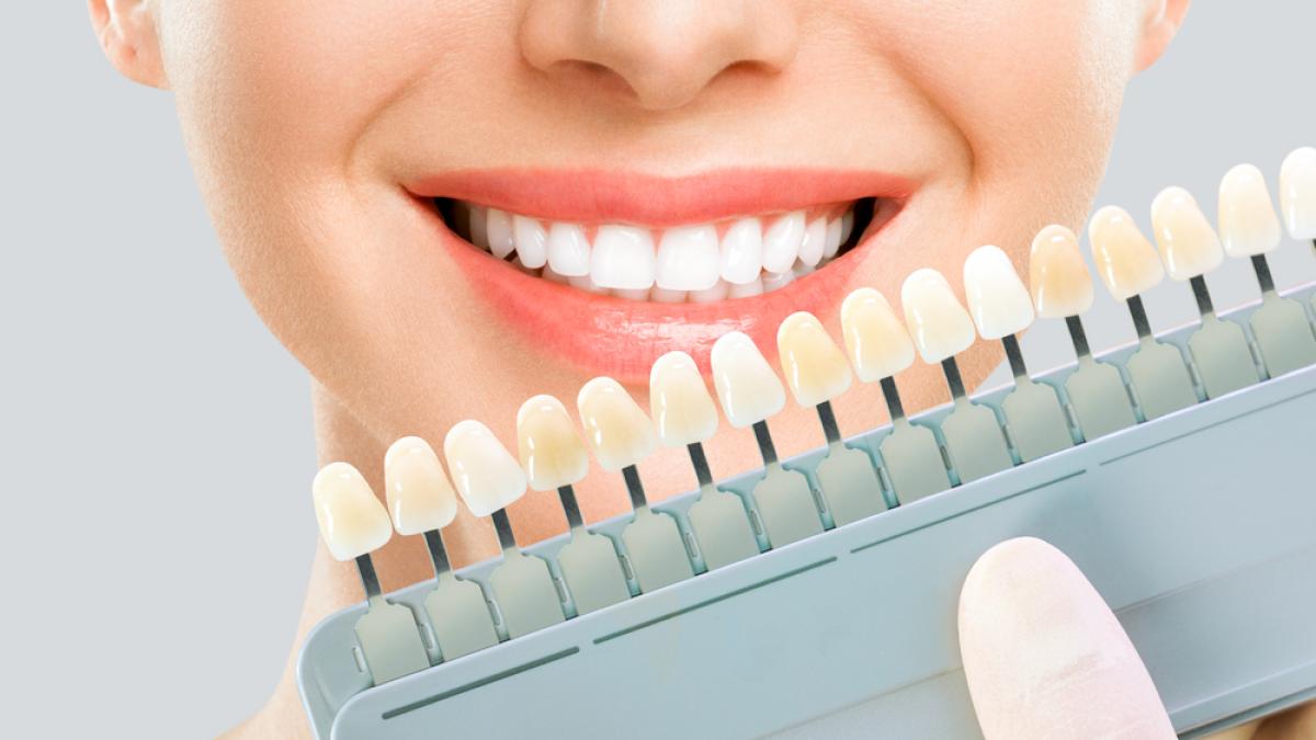 7 sfaturi pentru a păstra dantura albă fără a afecta smalțul dentar